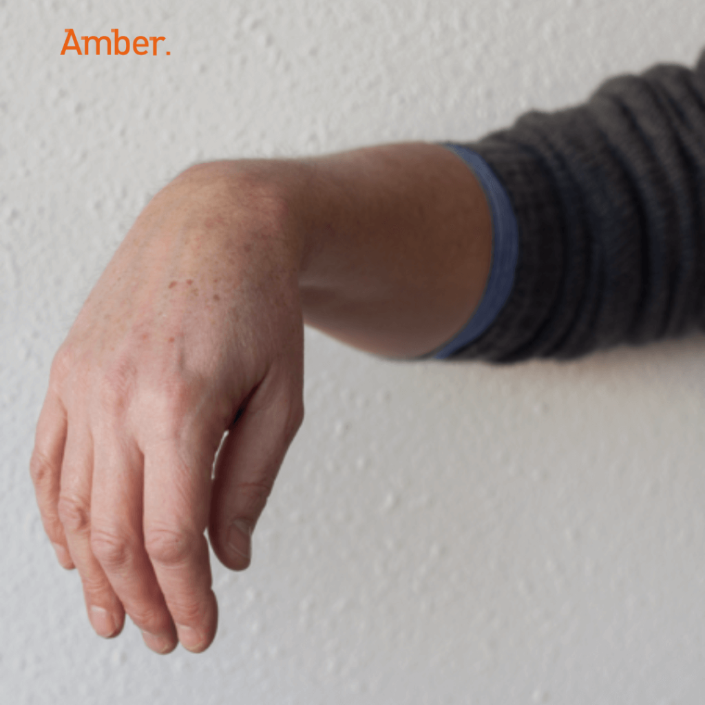 Symptome der Fallhand Verstehen und Linderung Finden - Amber Orthotics